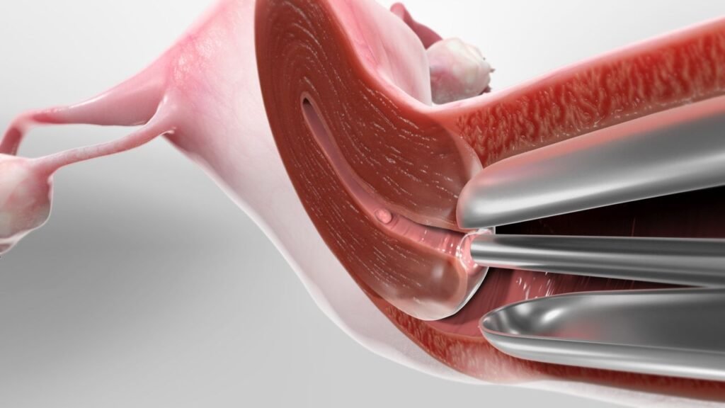 Hysteroscopy Treatment | Diagnosis & Uterine Care